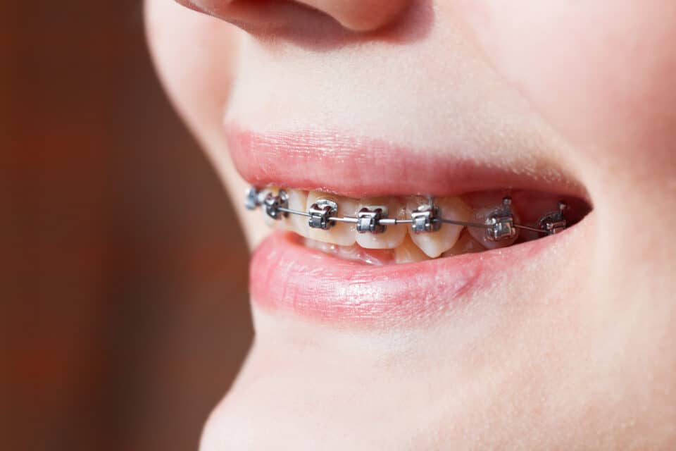 210 Orthodontics | Orthodontist in San Antonio, TX